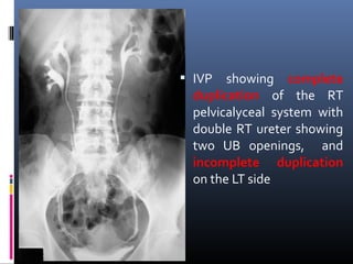 Imaging For Medical Students (Renal System) | PPT