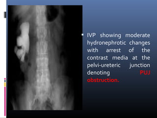 Imaging For Medical Students (Renal System) | PPT