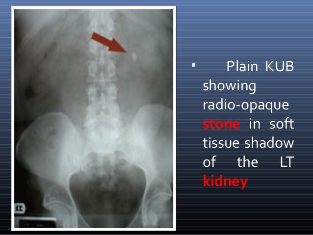 Imaging For Medical Students (Renal System)