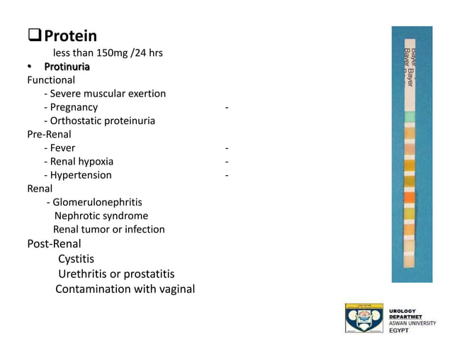 urinalysis | PPTX