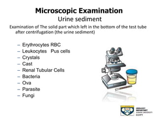 urinalysis | PPTX