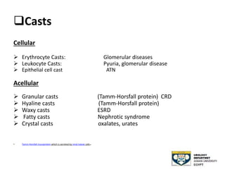 urinalysis | PPTX