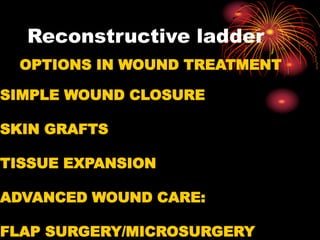 princeples of reconstruction.ppt