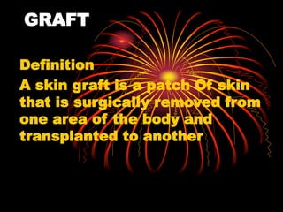 princeples of reconstruction.ppt