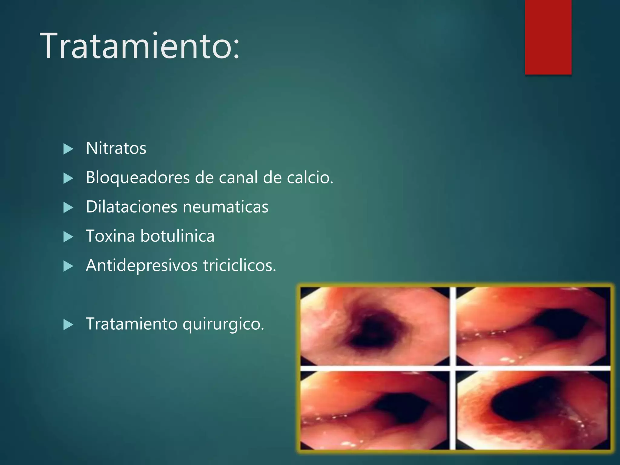 6 trastornos motores del esofago | PPTX | Digestive Disorders ...