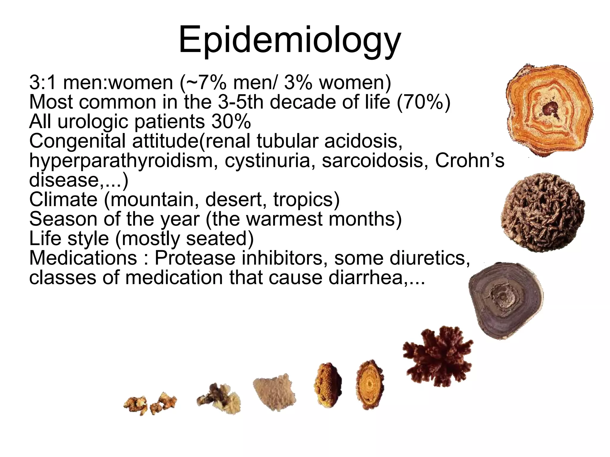 Urolithiasis.pptx | Medical Health