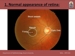 Skills in Retinal disease diagnosis.pptx