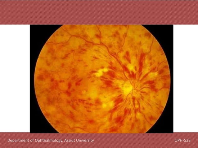 Skills in Retinal disease diagnosis.pptx