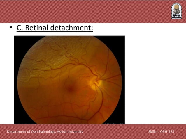 Skills in Retinal disease diagnosis.pptx