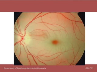 Skills in Retinal disease diagnosis.pptx