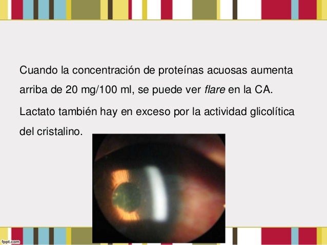 7. hidrodinámica del humor acuoso