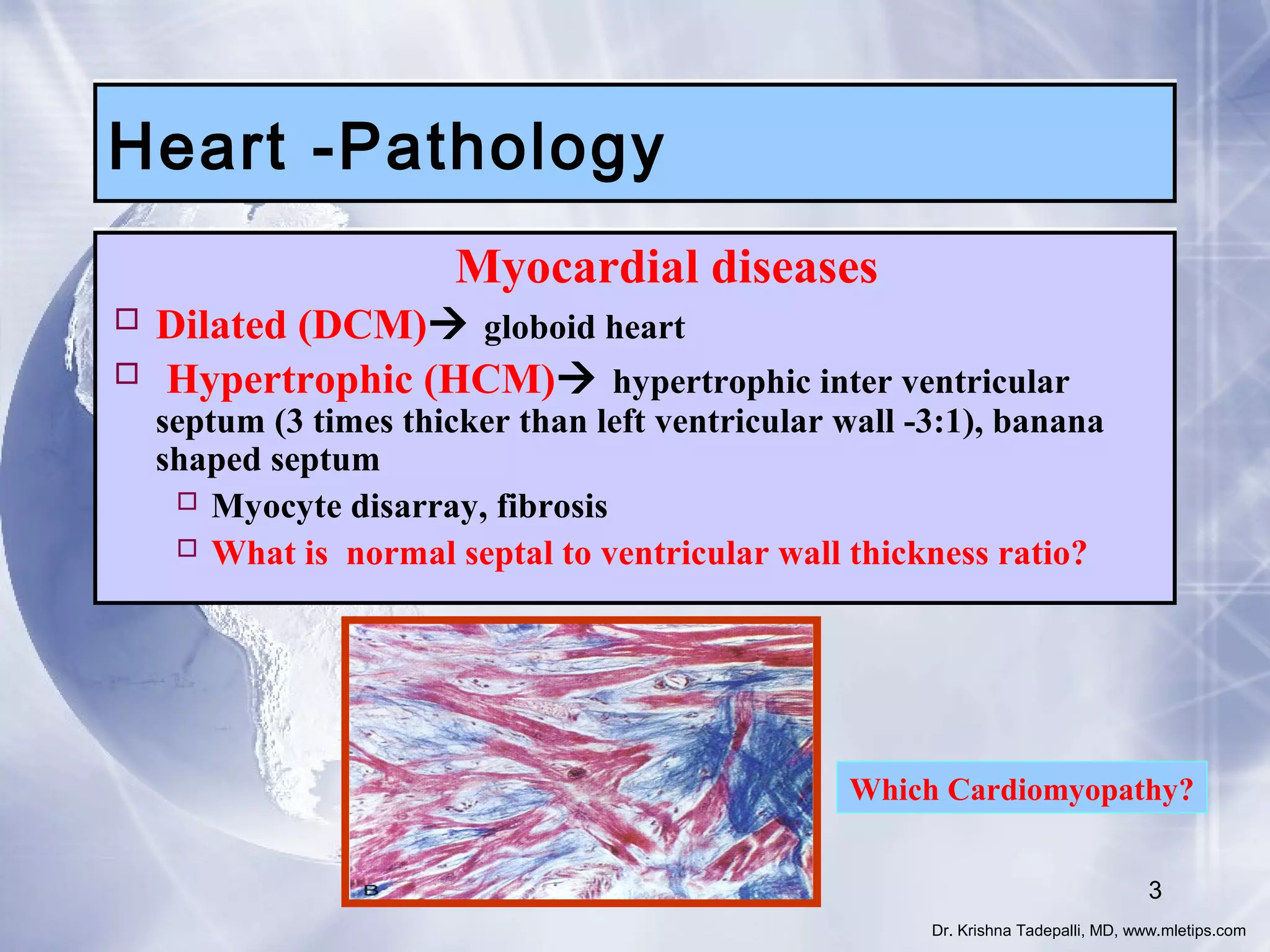 7. heart pathology; myocadial diseases | PPT