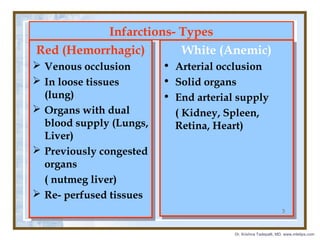 7. infarction; hemodynamic disorders | PPT