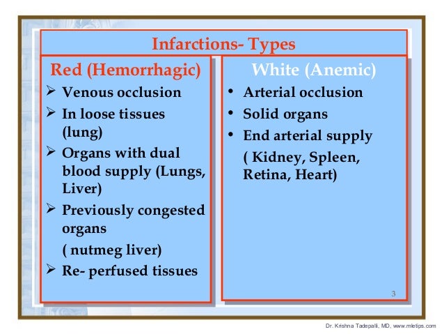 7. infarction; hemodynamic disorders