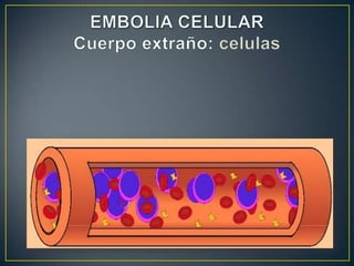 embolia | PPTX