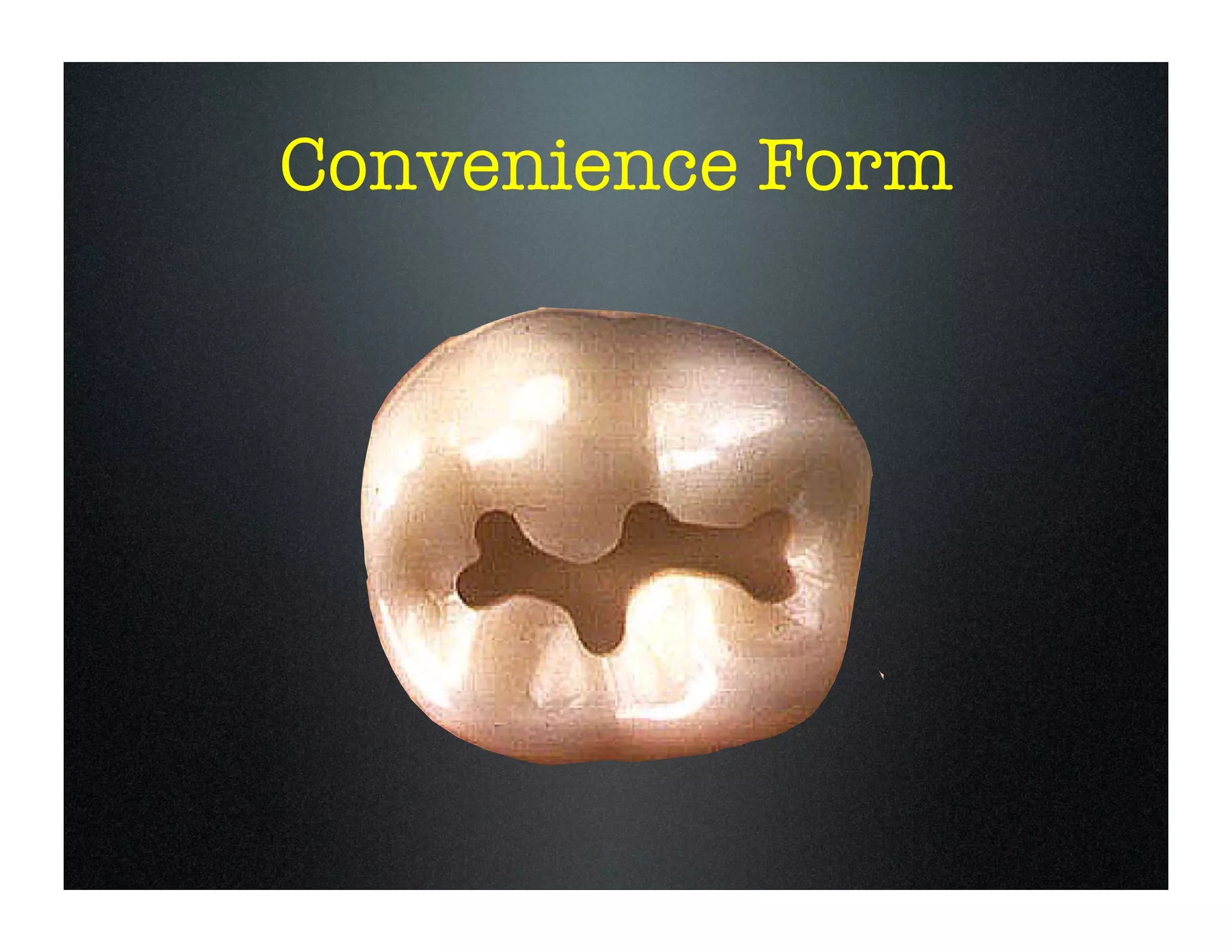 amalgam cavity preparation class i | PDF