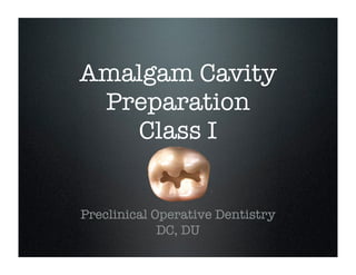 amalgam cavity preparation class i | PDF