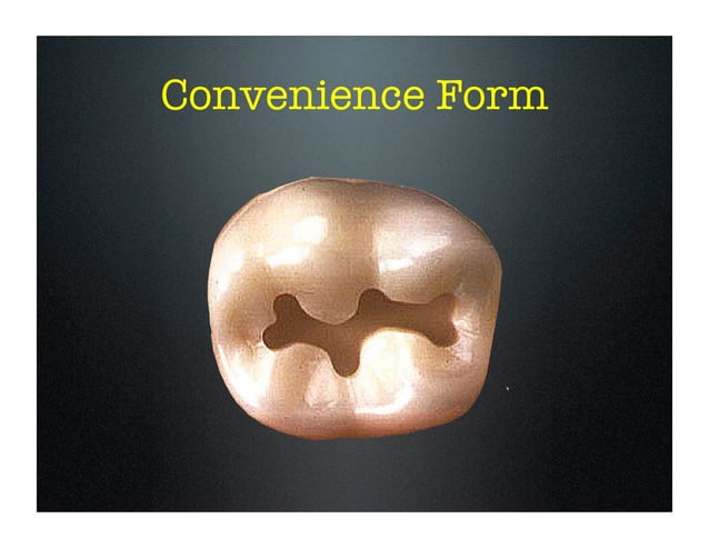 amalgam cavity preparation class i | PDF | Dental Health | Diseases and ...