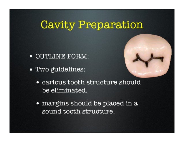 amalgam cavity preparation class i