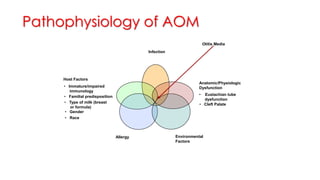 7. accute otitis media | PPTX