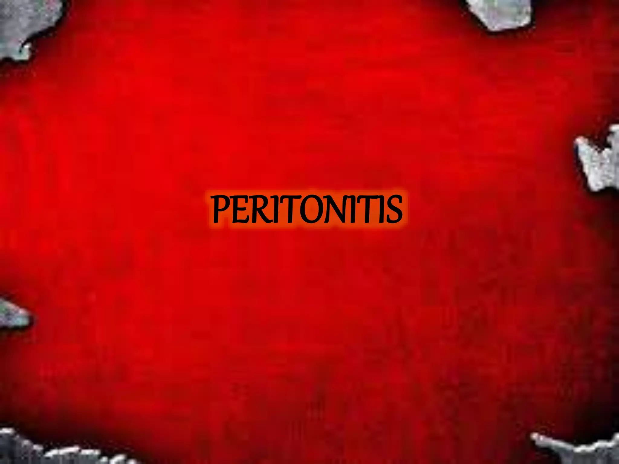 7. peritonitis | PPTX