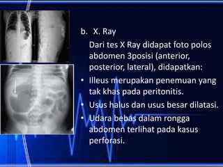 7. peritonitis | PPTX