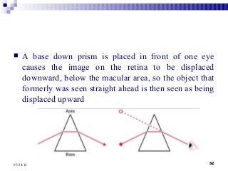Motor evaluation of strabismus | PPT