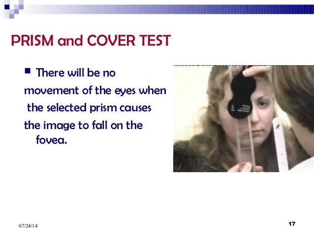 Motor evaluation of strabismus | PPT