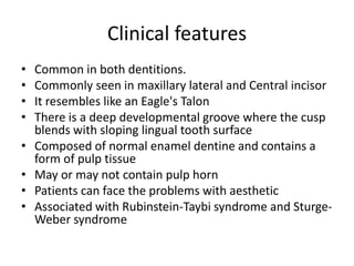 7.talon's cusp | PPTX
