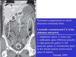 7. espaços anatômicos do abdome rx do trauma | PPTX