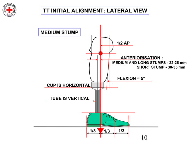 Transtibial Initial Alignment | PPT