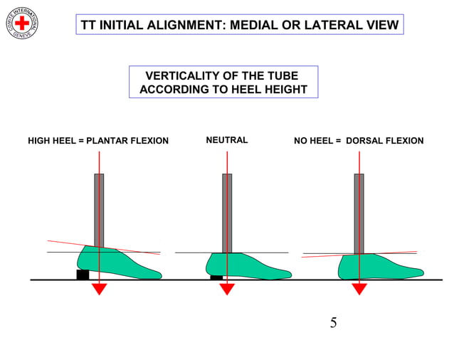 Transtibial Initial Alignment | PPT