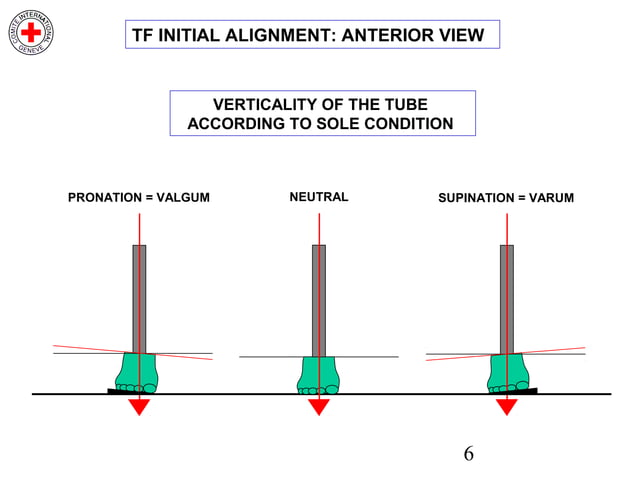 Transtibial Initial Alignment | PPT
