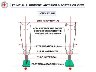 Transtibial Initial Alignment | PPT