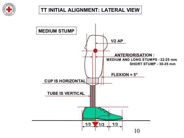 Transtibial Initial Alignment