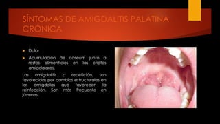 Semiología de faringitis y amigdalitis | PPTX