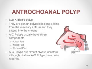 Nasal polyposis | PPTX
