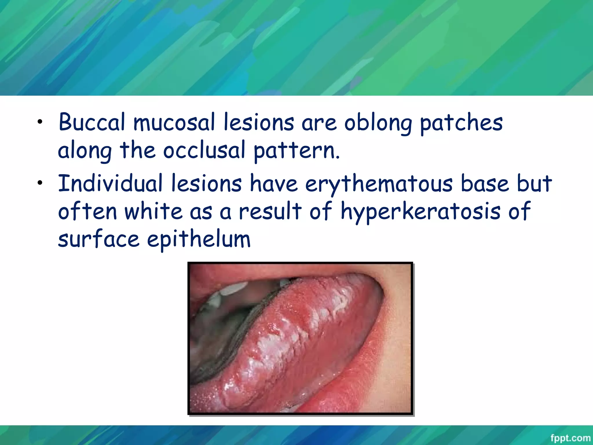 chemical injuries to orofacial structures | PPT
