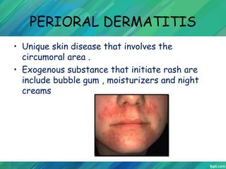 chemical injuries to orofacial structures | PPT