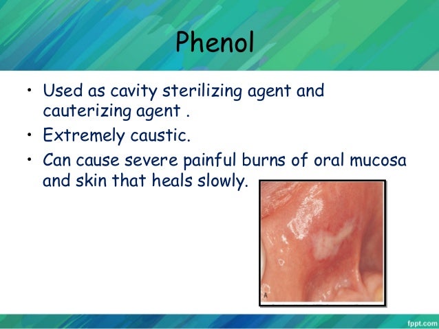 chemical injuries to orofacial structures