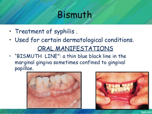 chemical injuries to orofacial structures