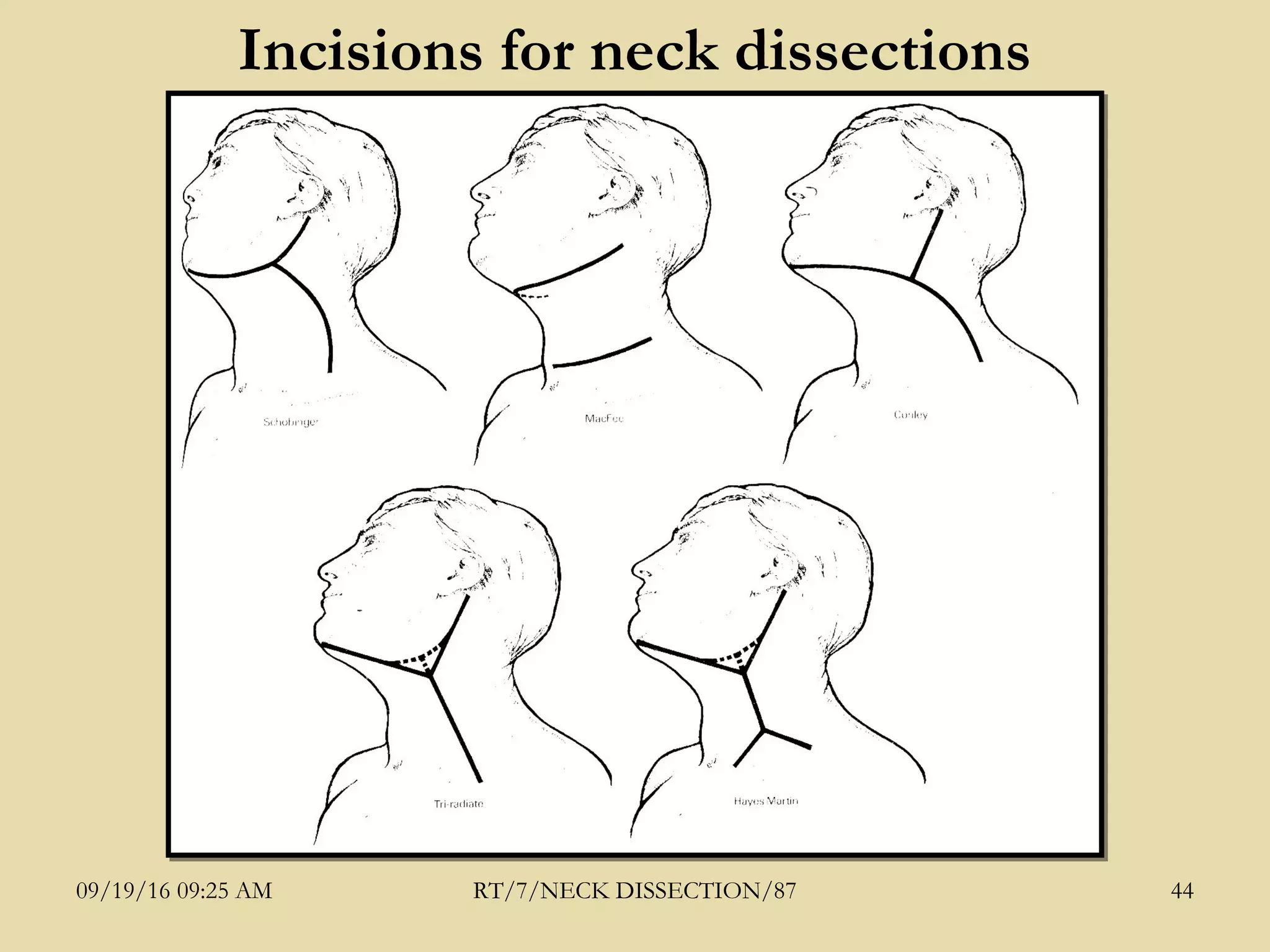 7. neck dissection(87) Dr. RAHUL TIWARI | PPT