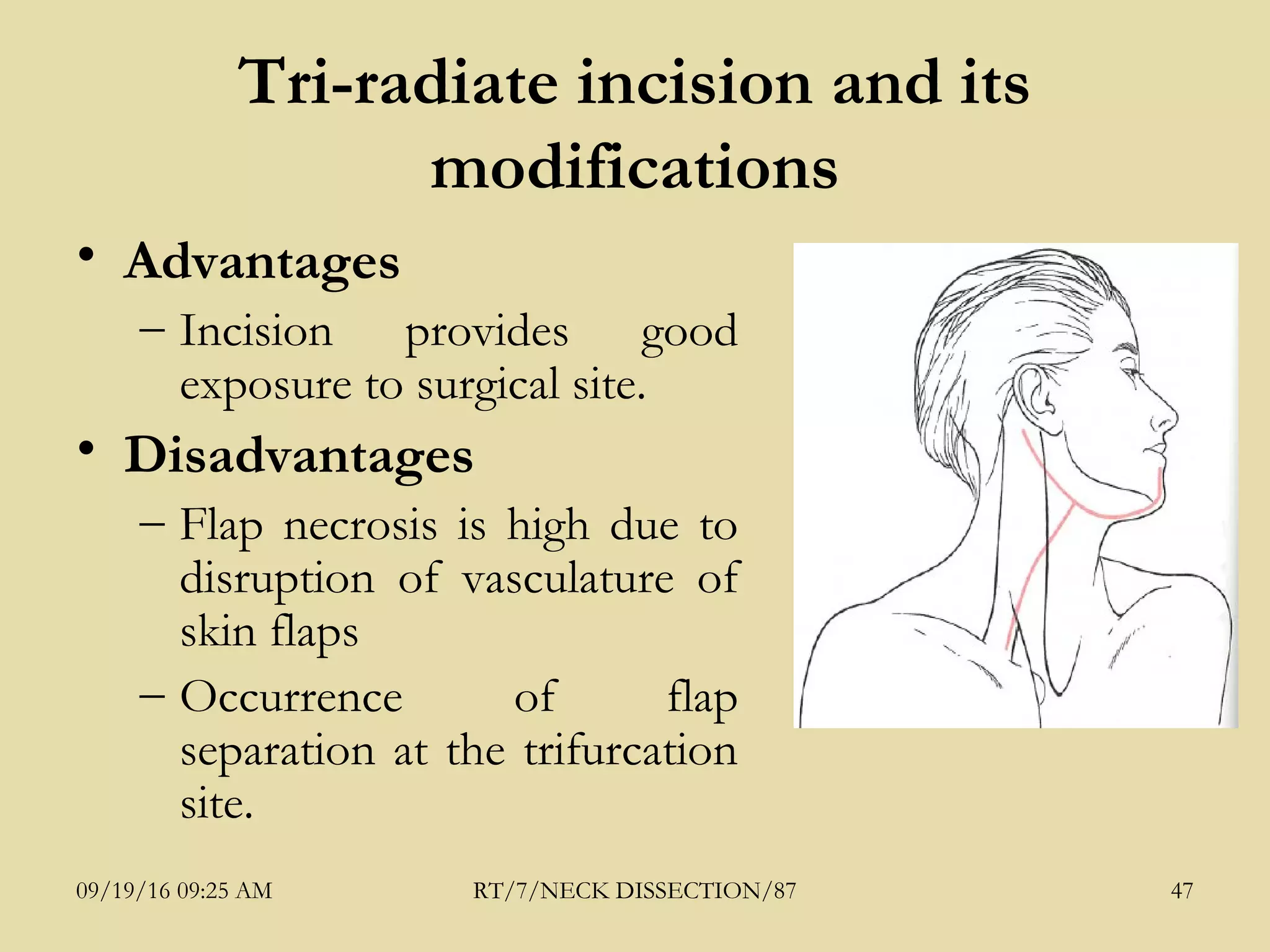 7. neck dissection(87) Dr. RAHUL TIWARI | PPT