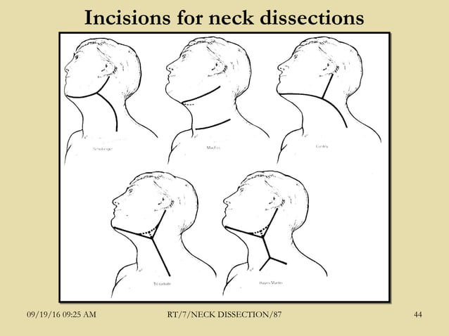 7. neck dissection(87) Dr. RAHUL TIWARI | PPT | Thyroid Disorders ...