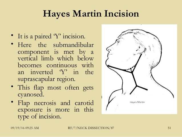 7. neck dissection(87) Dr. RAHUL TIWARI 7. neck dissection(87) Dr. RAHUL TIWARI