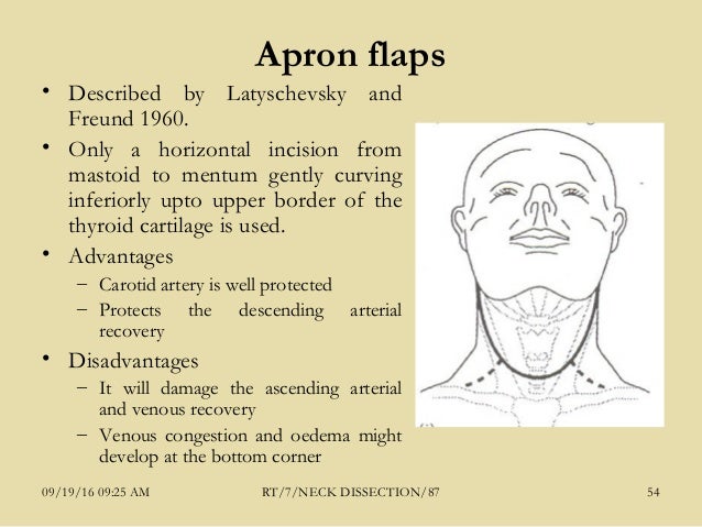 7. neck dissection(87) Dr. RAHUL TIWARI