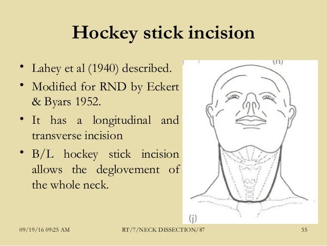 7. neck dissection(87) Dr. RAHUL TIWARI