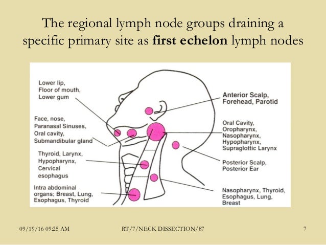 7. neck dissection(87) Dr. RAHUL TIWARI