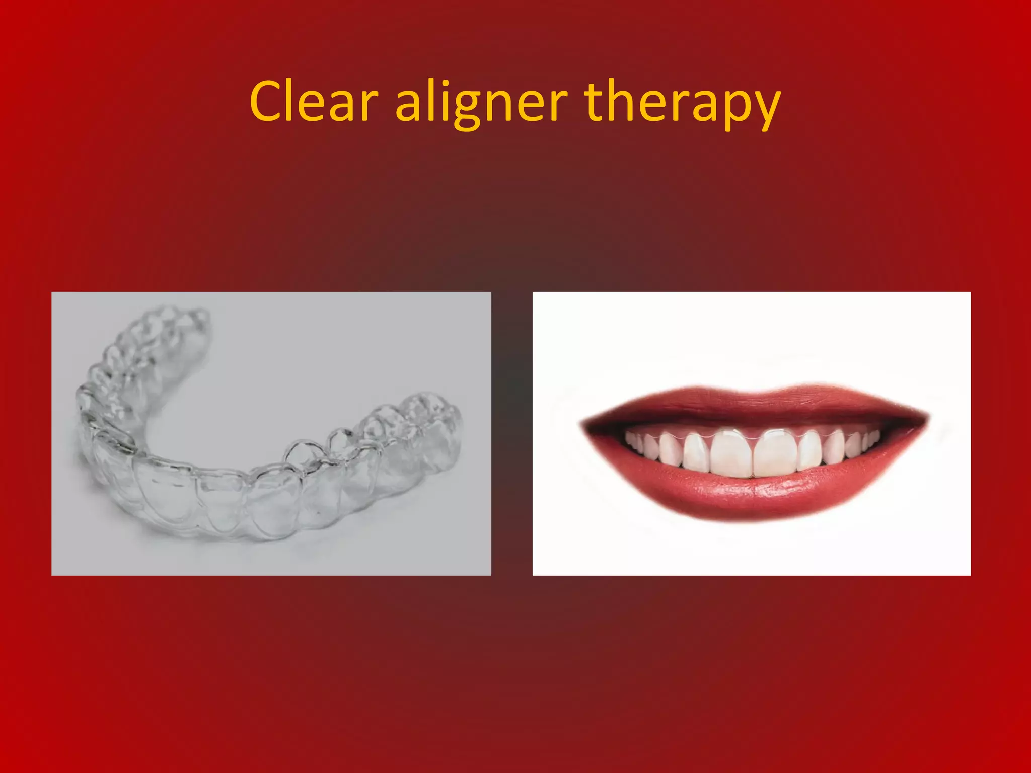 7.recent advances in dentistry | PPT