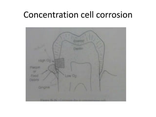 Corrosion of dental materials | PPTX